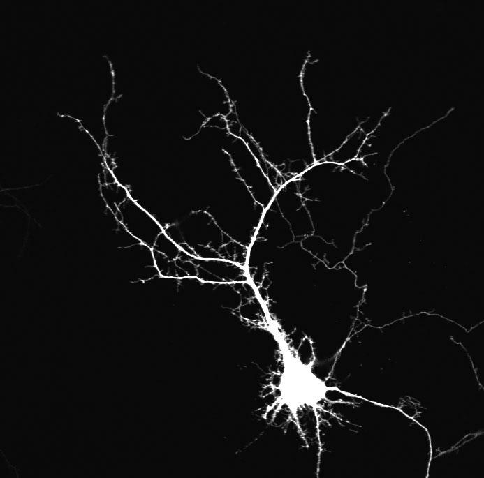 Dendrite Tree [IMAGE] | EurekAlert! Science News Releases