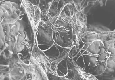 Segmented Filamentous Bacteriu [IMAGE] | EurekAlert! Science News Releases