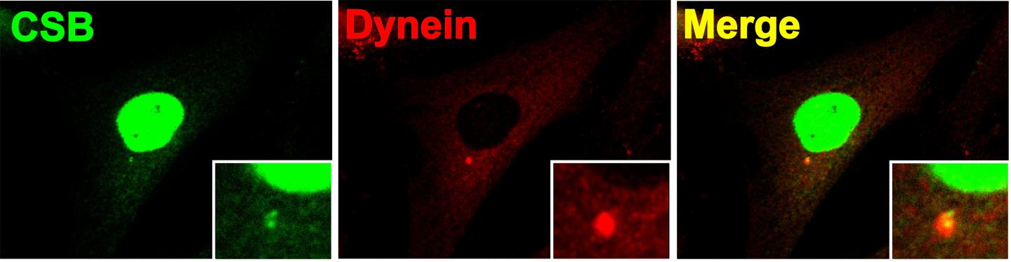 Skin Abnormalities in Premature Aging Disorde | EurekAlert!