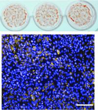 Finding the Kinases That Power Brown Fat | EurekAlert!