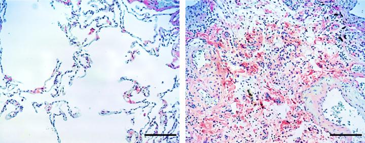 Lumican In Lungs [IMAGE] | EurekAlert! Science News Releases