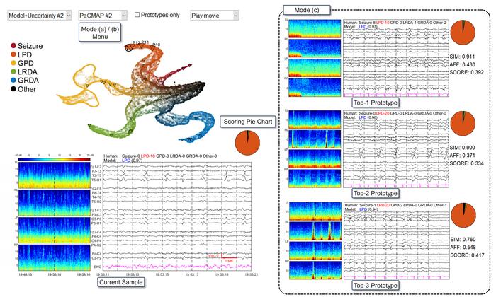 seizure AI in action [IMAGE] | EurekAlert! Science News Releases