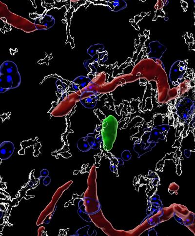 T Cell in the Mouse Brain [IMAGE] | EurekAlert! Science News Releases