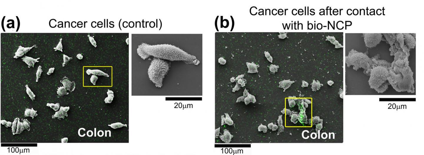 Cancer treatment on a cellular level | EurekAlert!
