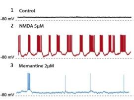 Extrasynaptic Excitations [IMAGE] | EurekAlert! Science News Releases