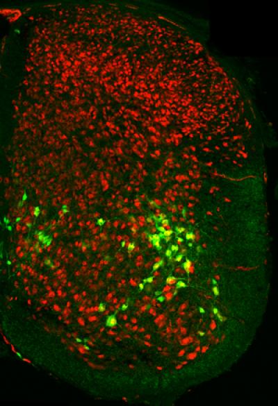 V2b Interneurons [IMAGE] | EurekAlert! Science News Releases