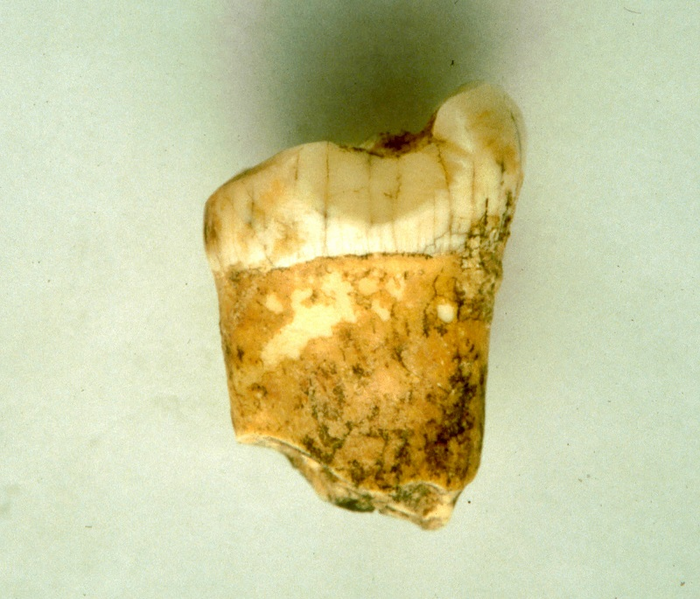 A first molar from a Neanderth [IMAGE] | EurekAlert! Science News Releases