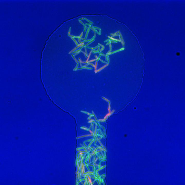 Mycobacteria Growth 2 [IMAGE] | EurekAlert! Science News Releases