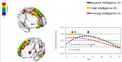Cortex matures faster in youth with highest I | EurekAlert!