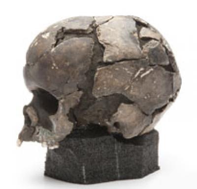 Scanning the Skull [IMAGE] | EurekAlert! Science News Releases