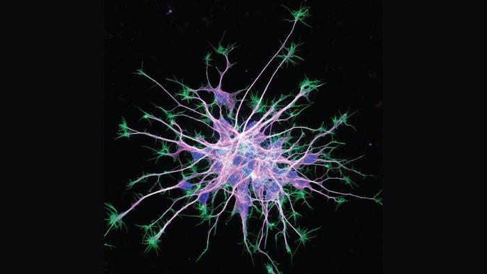 Neuronal Cytoskeleton [IMAGE] | EurekAlert! Science News Releases