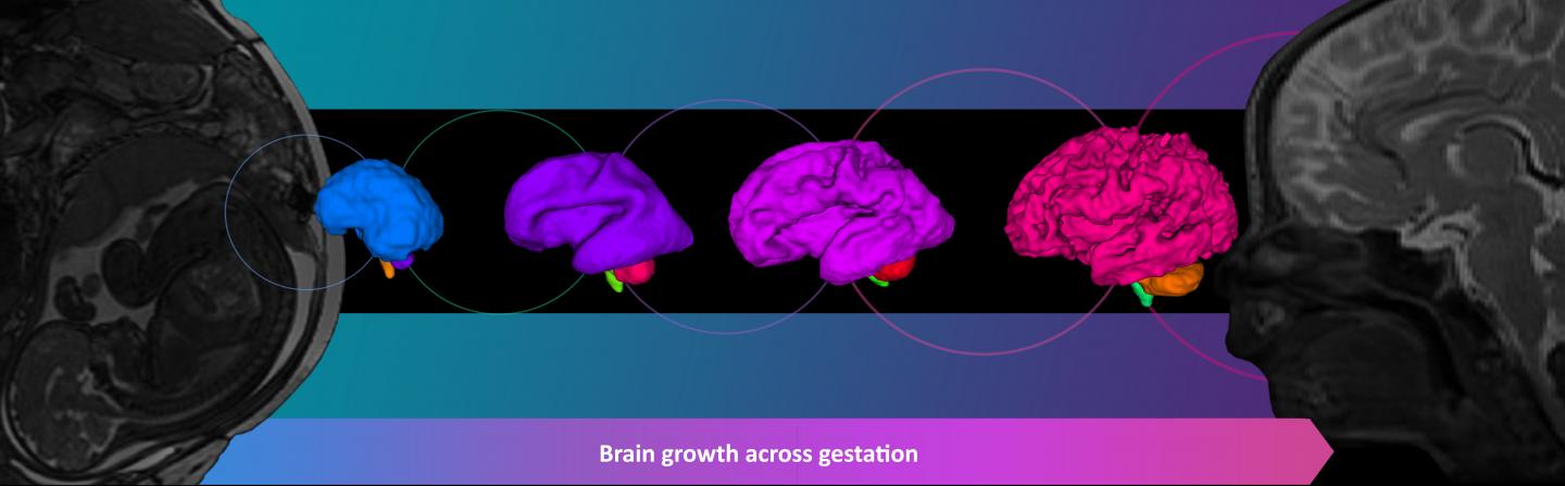 The Developing Brain [IMAGE] | EurekAlert! Science News Releases