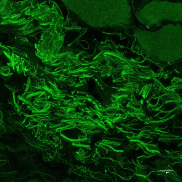 Eye microbiome trains immune cells to fend of | EurekAlert!