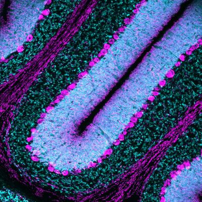 Purkinje cells [IMAGE] | EurekAlert! Science News Releases