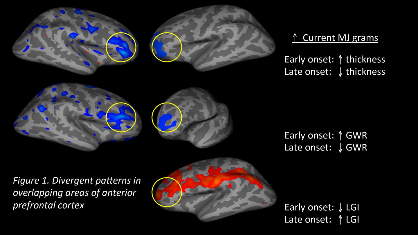 Brain Imaging Patterns in the [IMAGE] | EurekAlert! Science News Releases