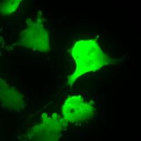 Invadopodia in Tumor Cell [IMAGE] | EurekAlert! Science News Releases