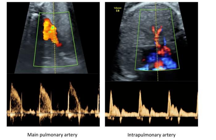 Pulmonary vascular reactivity [IMAGE] | EurekAlert! Science News Releases