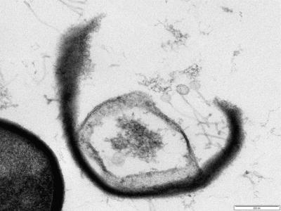 Burst Open Cell with Phages Es [IMAGE] | EurekAlert! Science News Releases