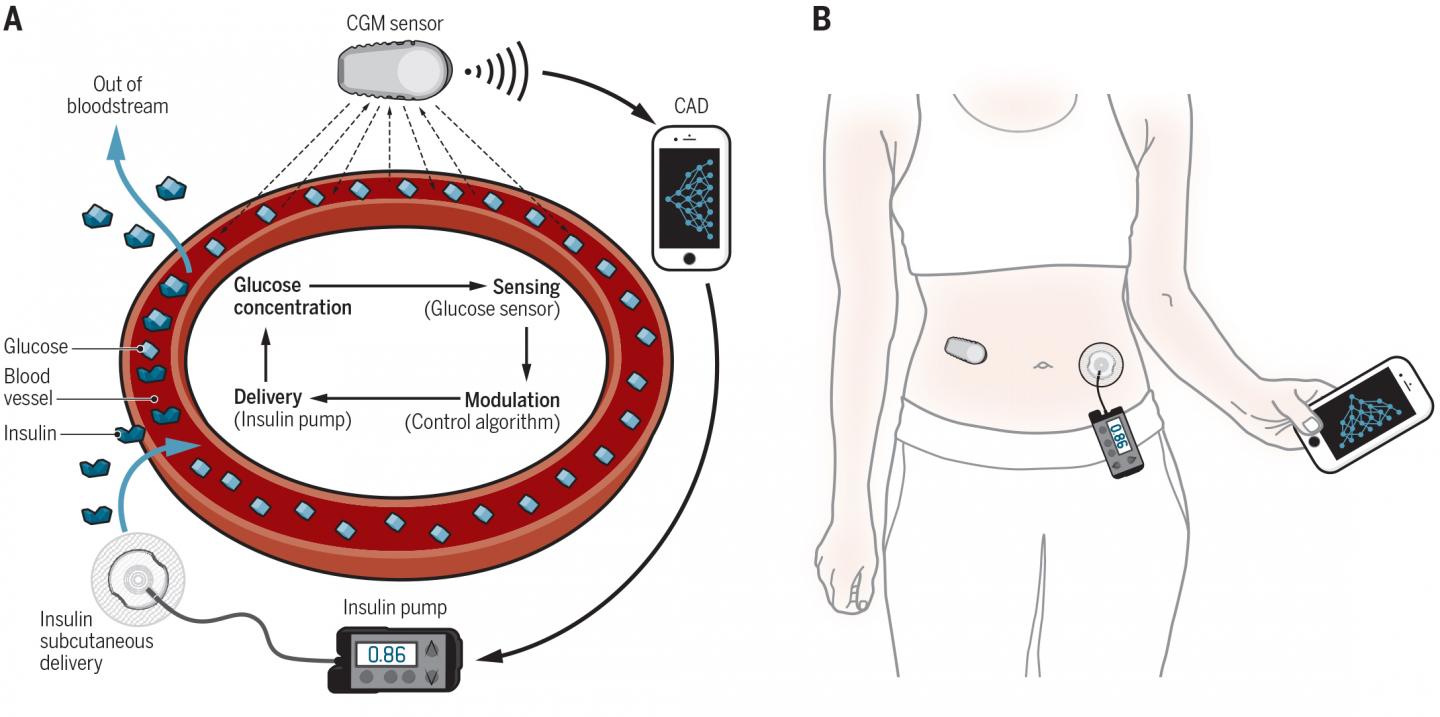 Artificial Pancreas Systems Could Transform t | EurekAlert!
