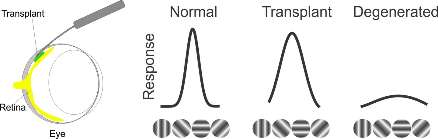 Retinal Sheet Transplant [IMAGE] | EurekAlert! Science News Releases