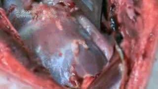 Electronic Tattoo Monitors Brain, Heart and M | EurekAlert!