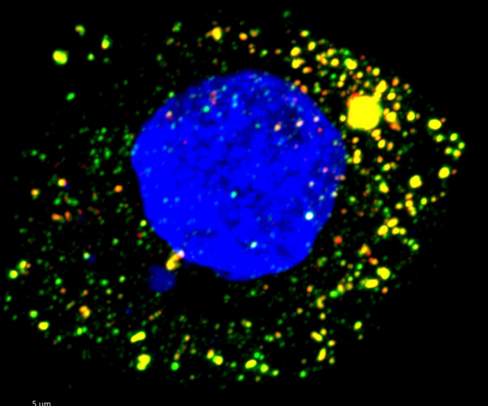 Scientists discover key to hepatitis A virus | EurekAlert!