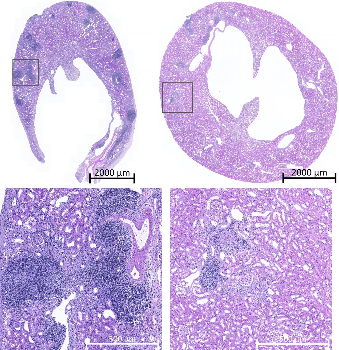 Image Of Transplanted Mouse Ki [image] Eurekalert Science News Releases