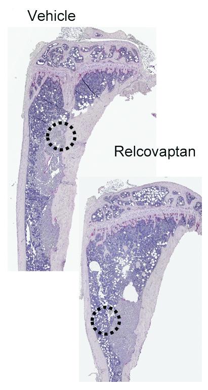 A Known-to-Be Safe Drug Candidate Inhibits Ad | EurekAlert!