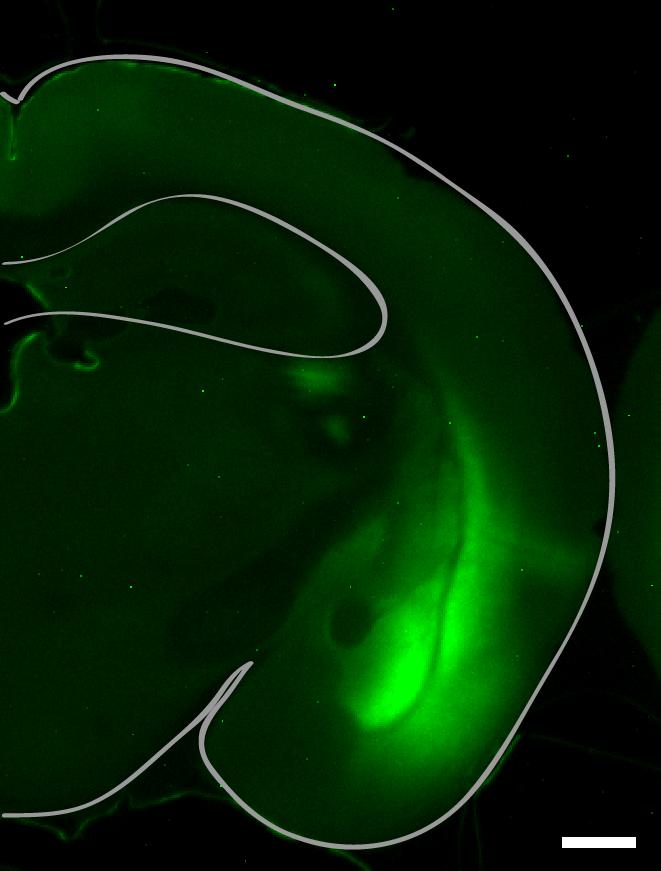 Mouse Brain [IMAGE] | EurekAlert! Science News Releases