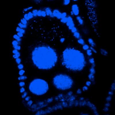 Fly Bacteria Protects Against Infertility (2 | EurekAlert!