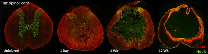 Progression of Injury in Rat S [IMAGE] | EurekAlert! Science News Releases