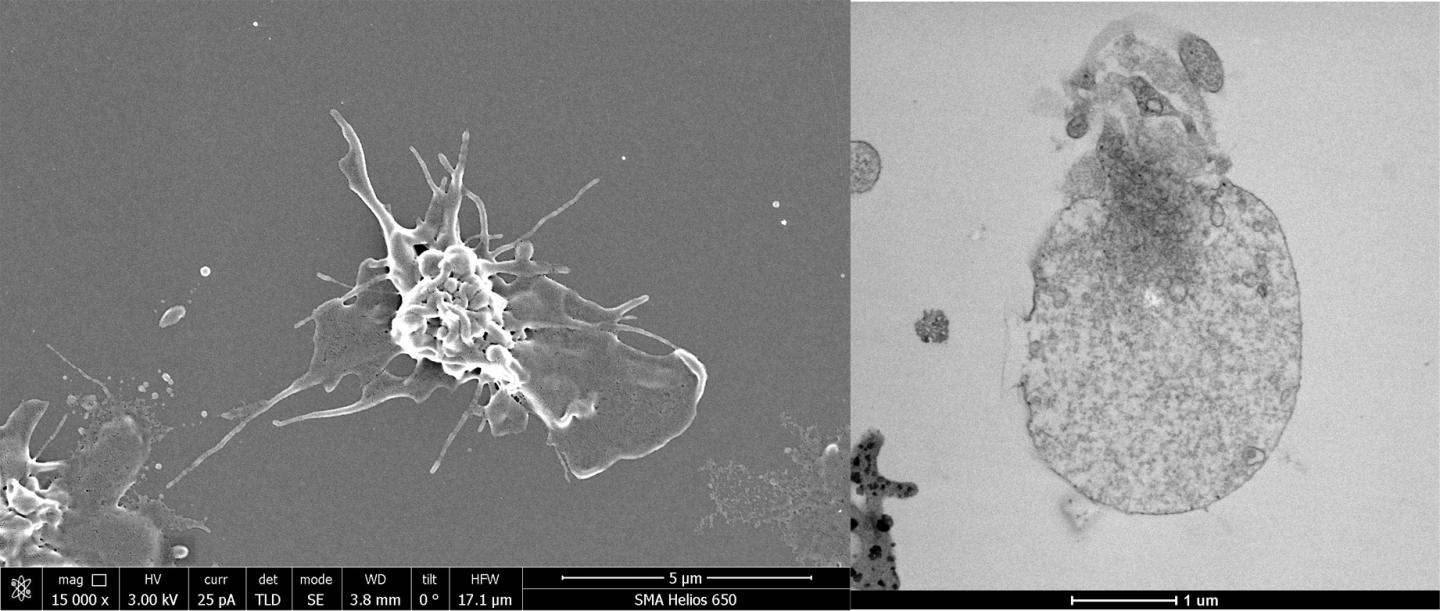 Figure 1: Platelets [IMAGE] | EurekAlert! Science News Releases