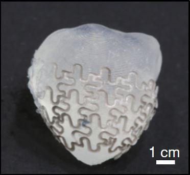 Mesh Implant Gives Failing Heart a Boost (2 o | EurekAlert!