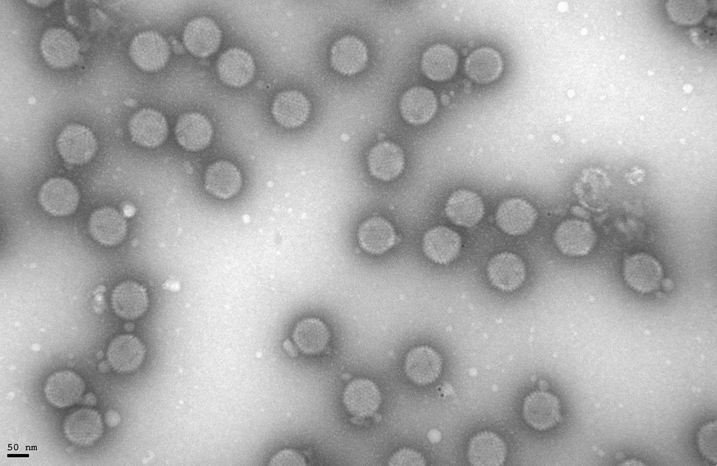 Virus-Based Therapy Targets a Pediatric Eye C | EurekAlert!