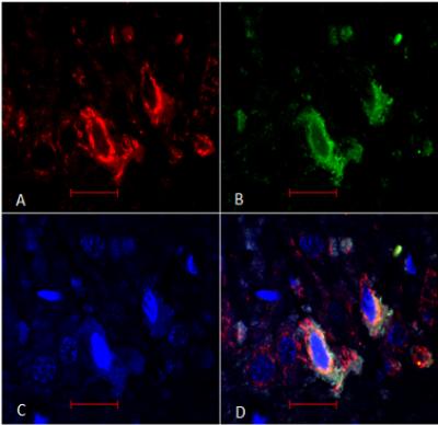 Electrical stimulation of fastigial nucleus a | EurekAlert!