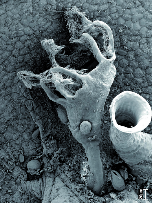 Close up image of a Kamptozoa [IMAGE] | EurekAlert! Science News Releases