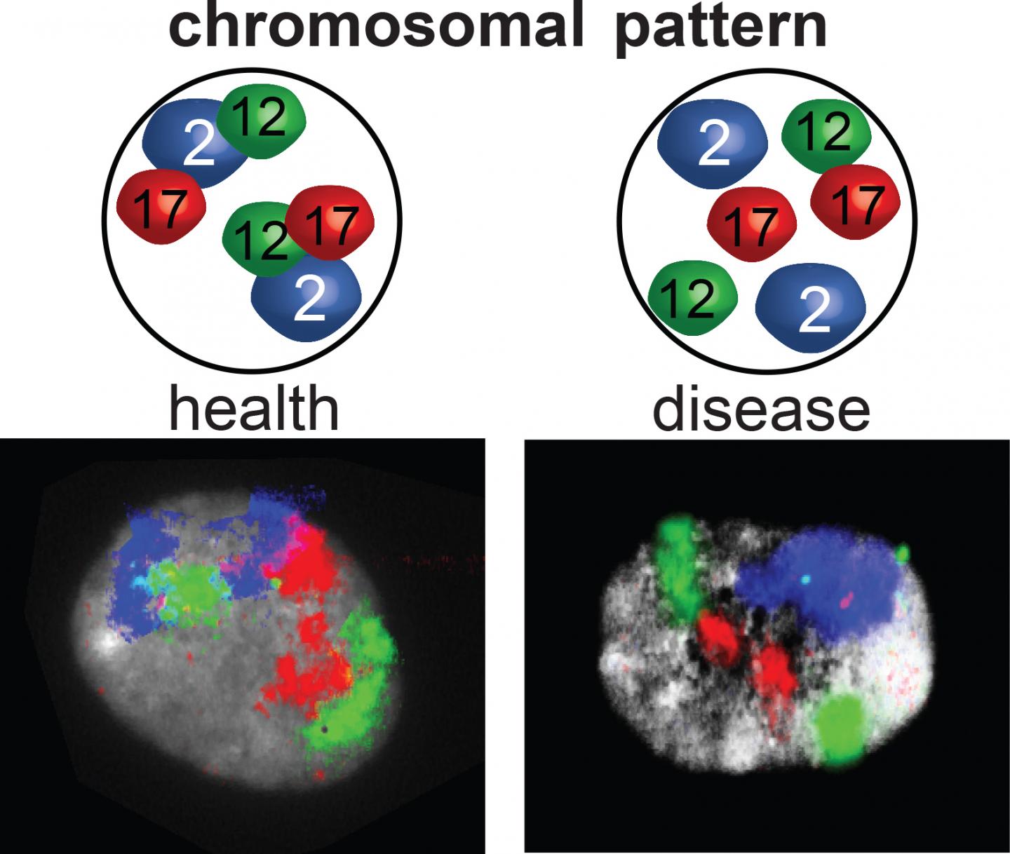 A case of 'kiss and tell': Chromosomal kissin | EurekAlert!