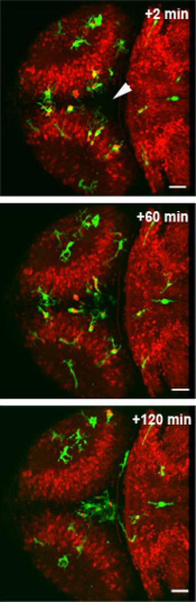 The Brain's First Responders [IMAGE] | EurekAlert! Science News Releases
