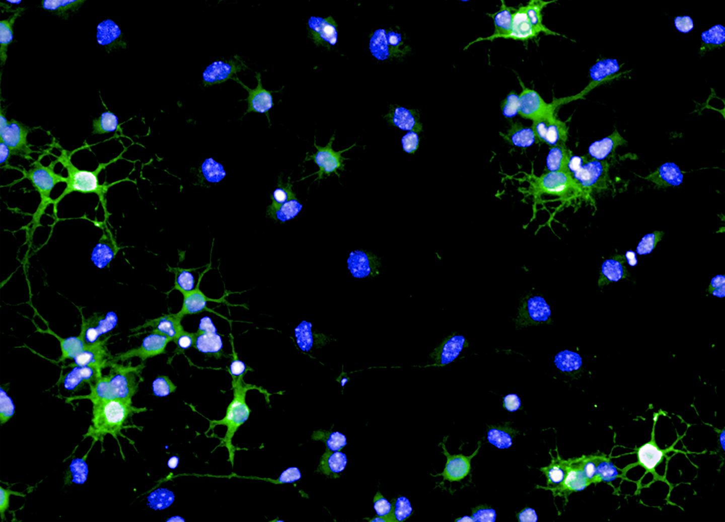 Multiple sclerosis -- Helping cells to help t | EurekAlert!