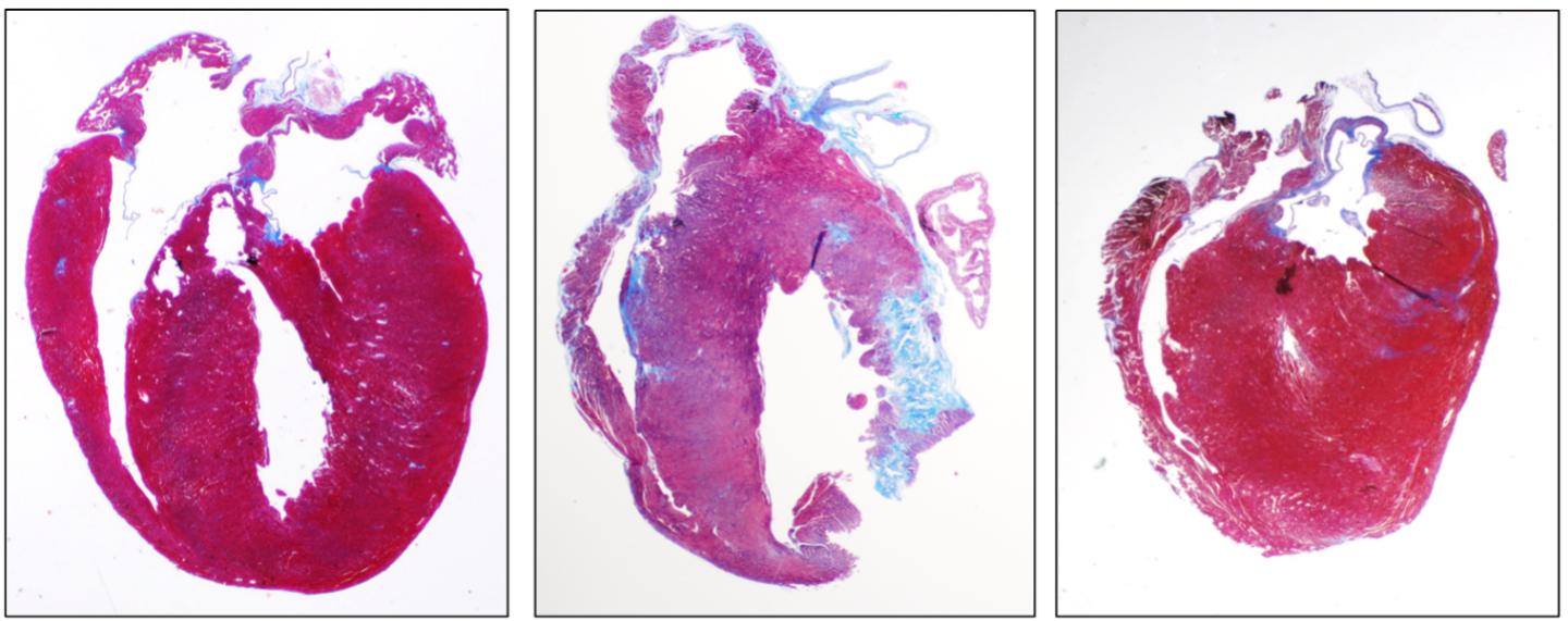 Healthy Mouse Heart [IMAGE] | EurekAlert! Science News Releases