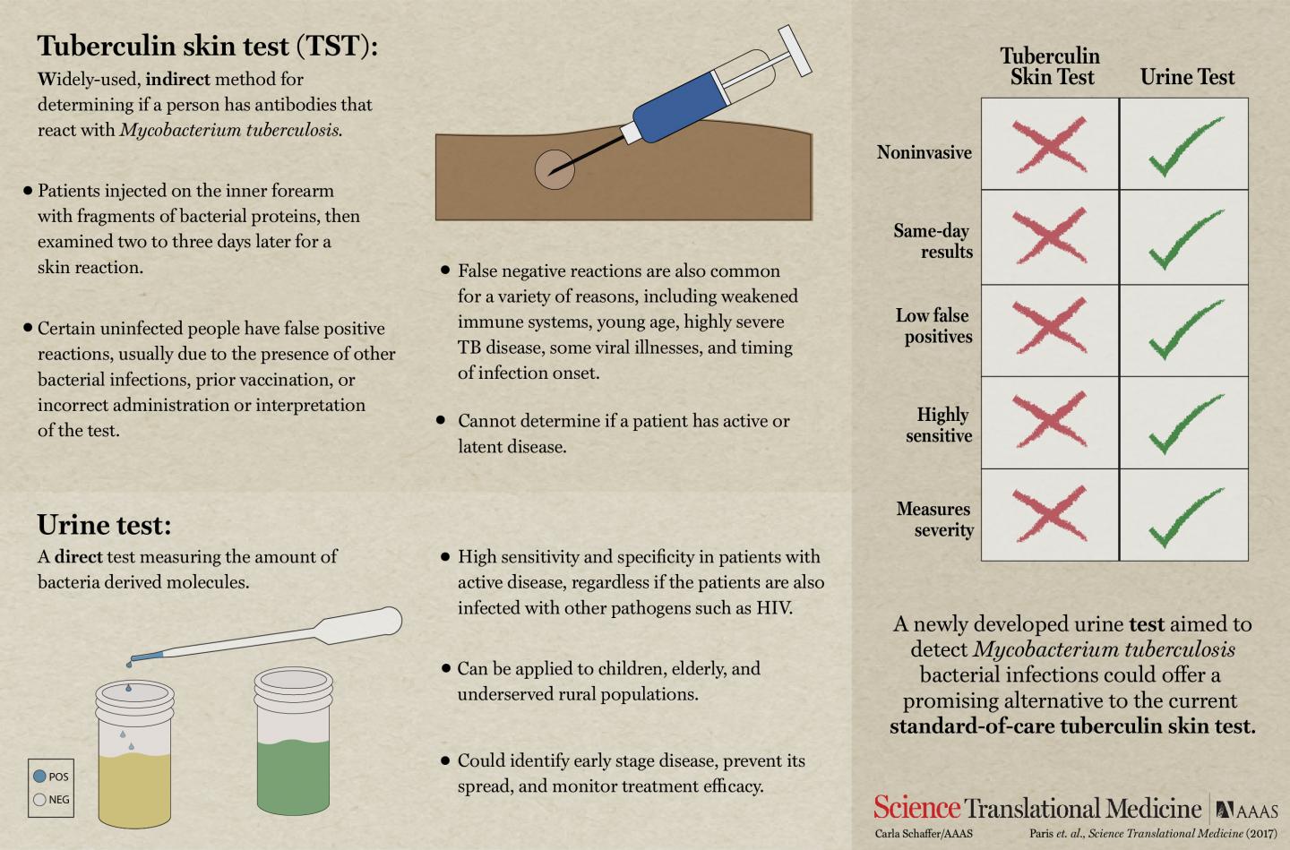 At Long Last, A Urine Test for Accurate Tuber | EurekAlert!