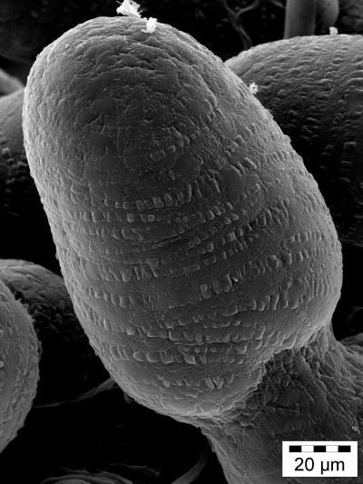 How Beetles Keep Bacteria in Check (6 of 15) | EurekAlert!