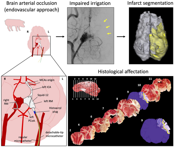 Graphical abstract [IMAGE] | EurekAlert! Science News Releases