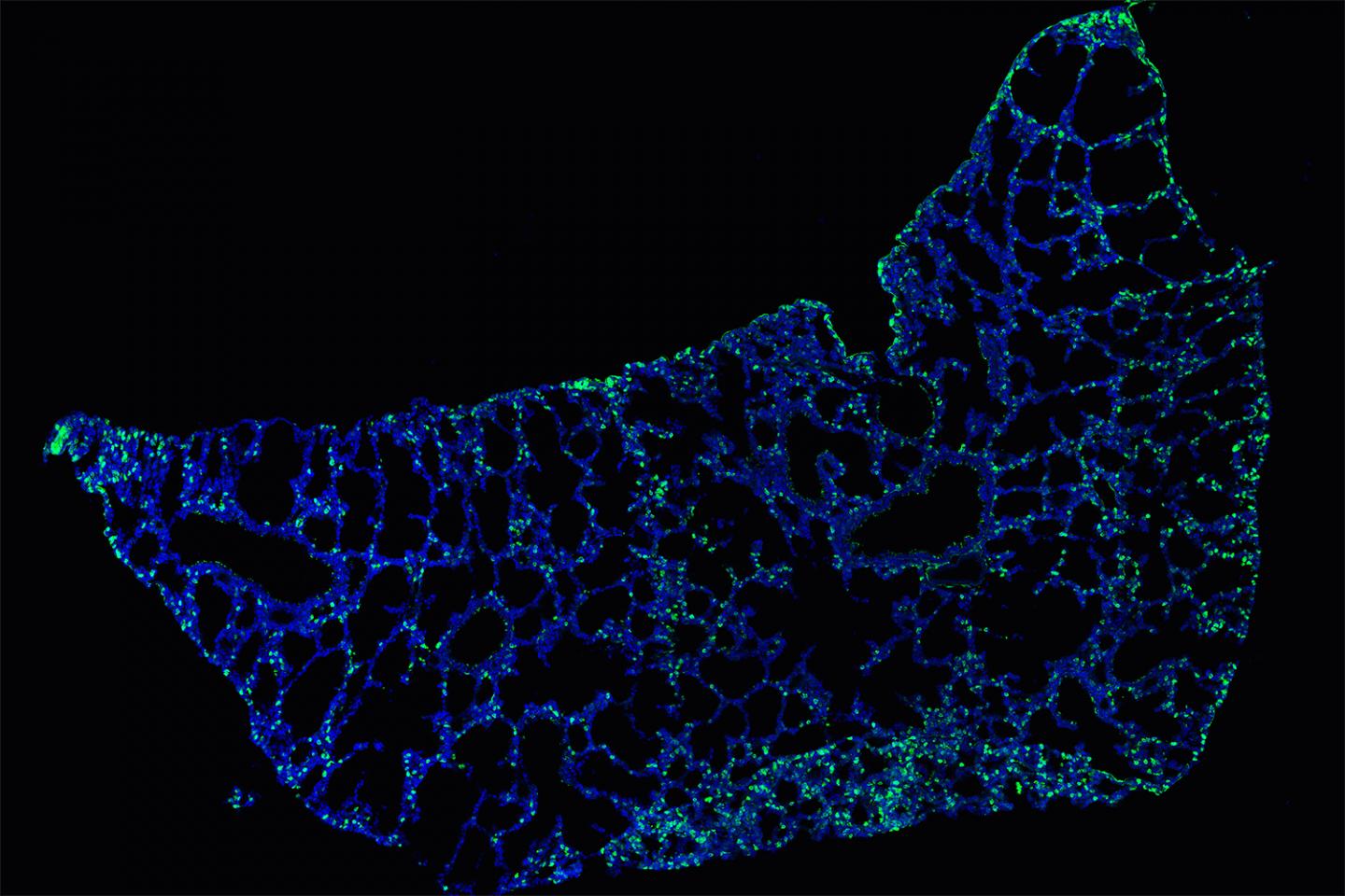 Fluorescent Staining [IMAGE] | EurekAlert! Science News Releases