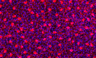 Confocal Micrograph [IMAGE] | EurekAlert! Science News Releases