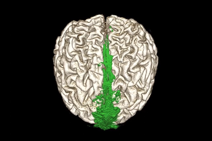 Seeing the Brain's Drains. [IMAGE] | EurekAlert! Science News Releases