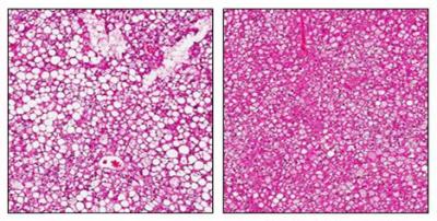 Fat Droplets in Liver Cells [IMAGE] | EurekAlert! Science News Releases