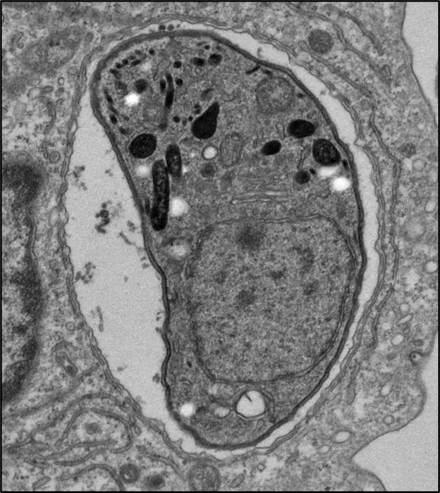 Novel genetic screen provides clues on how a | EurekAlert!