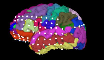 In-Brain Electrodes Study Memo [IMAGE] | EurekAlert! Science News Releases
