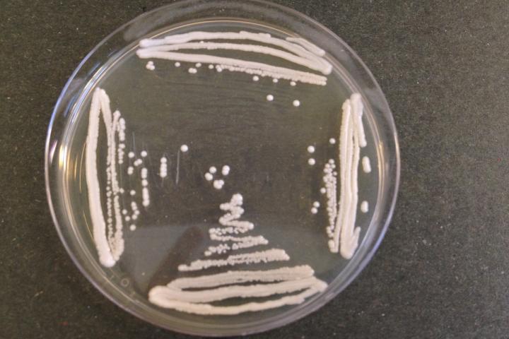 Candida [IMAGE] | EurekAlert! Science News Releases